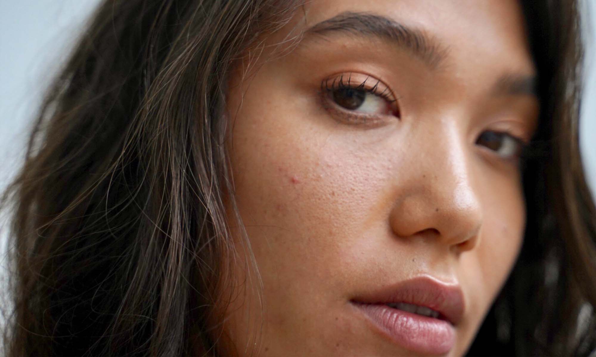 But Really... Can Pore Size Actually Be Reduced? – Skin Health Science